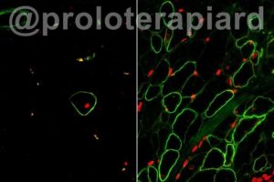 Investigadores de UCLA crean músculo esquelético a partir de células ...