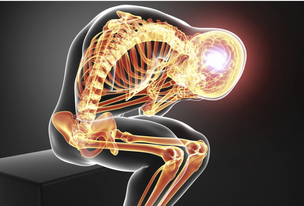 Un estudio de los NIH encuentra altas tasas de dolor crónico ...